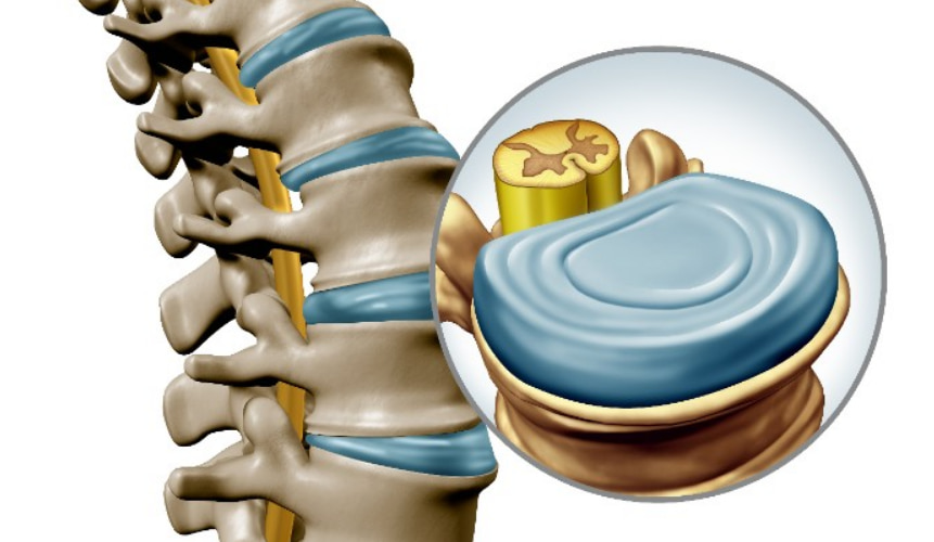 Coluna Vertebral: Entenda toda a sua estrutura! - ITC Vertebral
