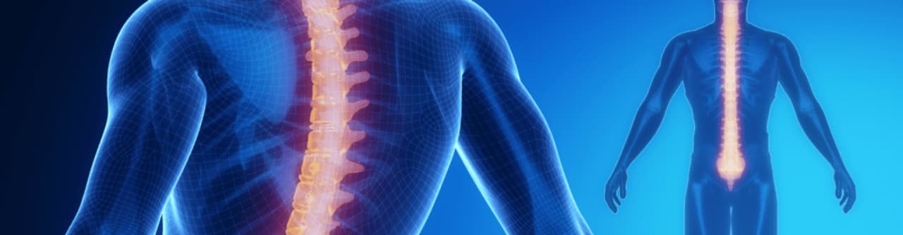 Cauda equina: O que é? - ITC Vertebral