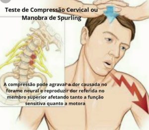Você sabe o que é Teste de Spurling? - ITC Vertebral
