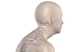 Corcunda no pescoço: causas e como resolver - ITC Vertebral