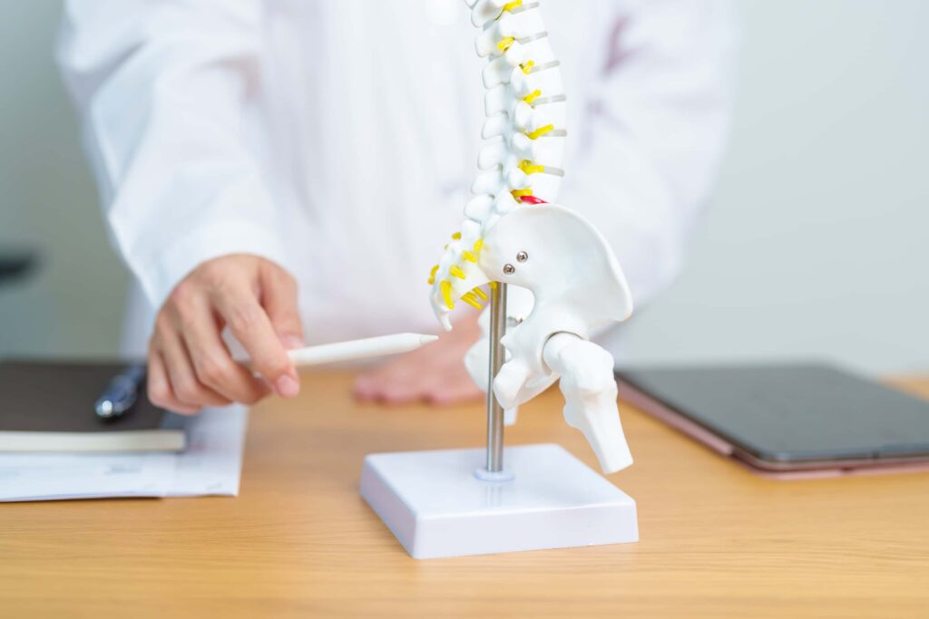 Cóccix desalinhado: causas, sintomas, tempo de recuperação - ITC Vertebral