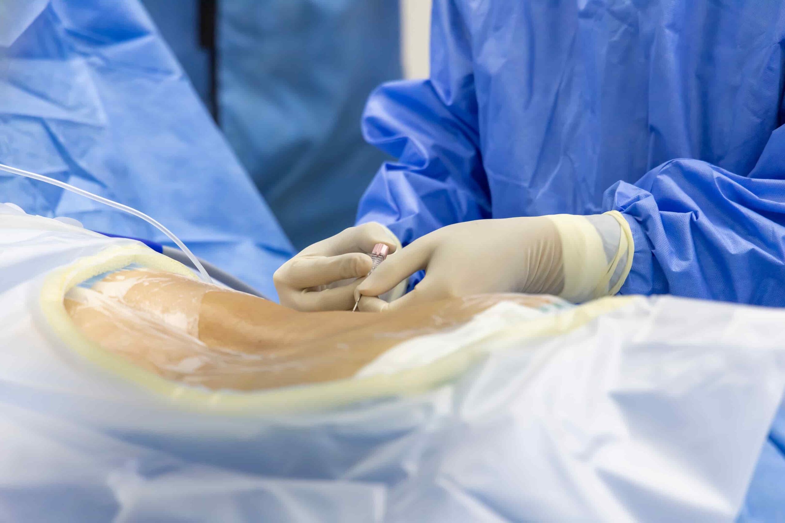 Microdiscectomia lombar: o que é, riscos e recuperação - ITC Vertebral