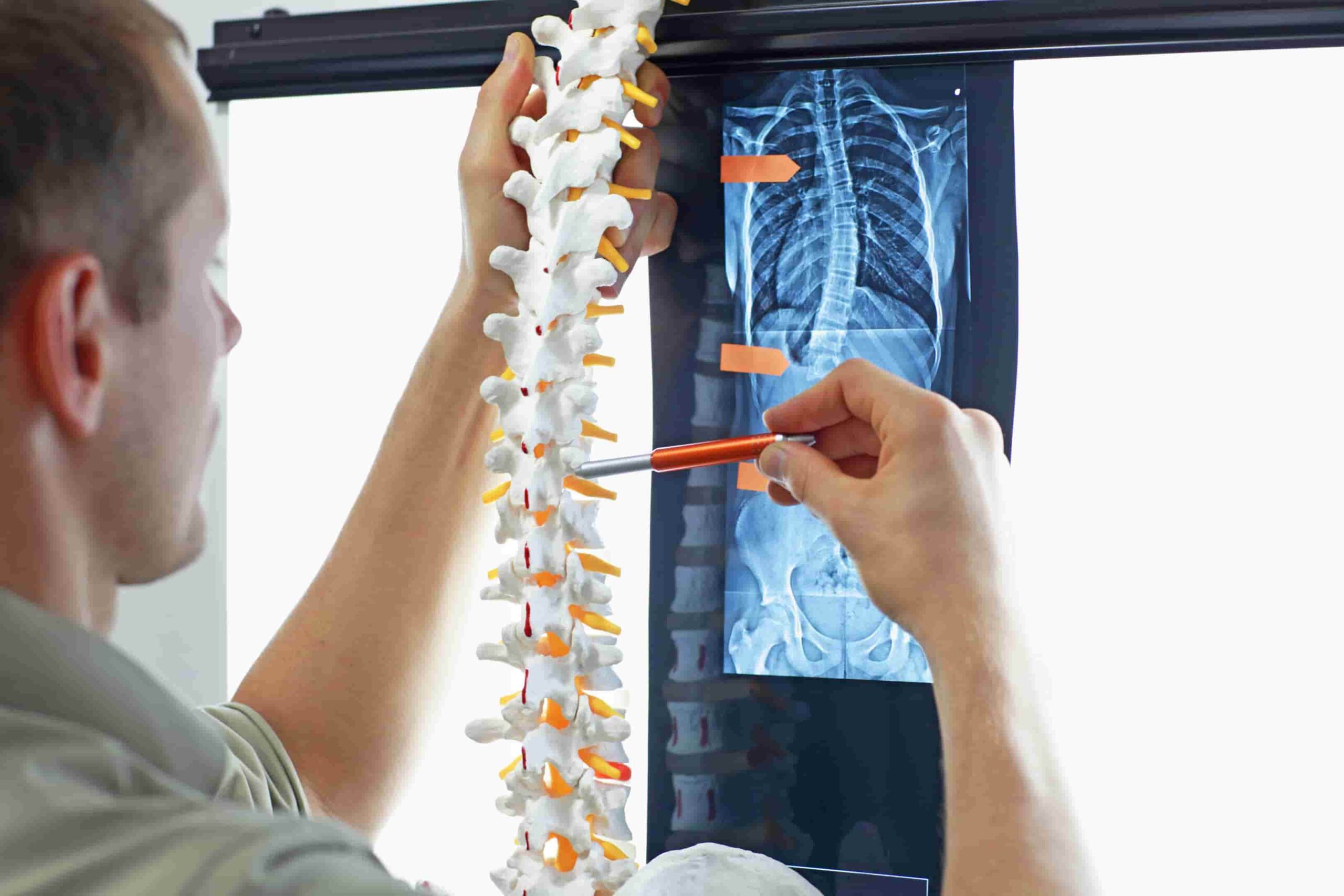Quando é necessário Diagnóstico por Imagem da Coluna? - ITC Vertebral