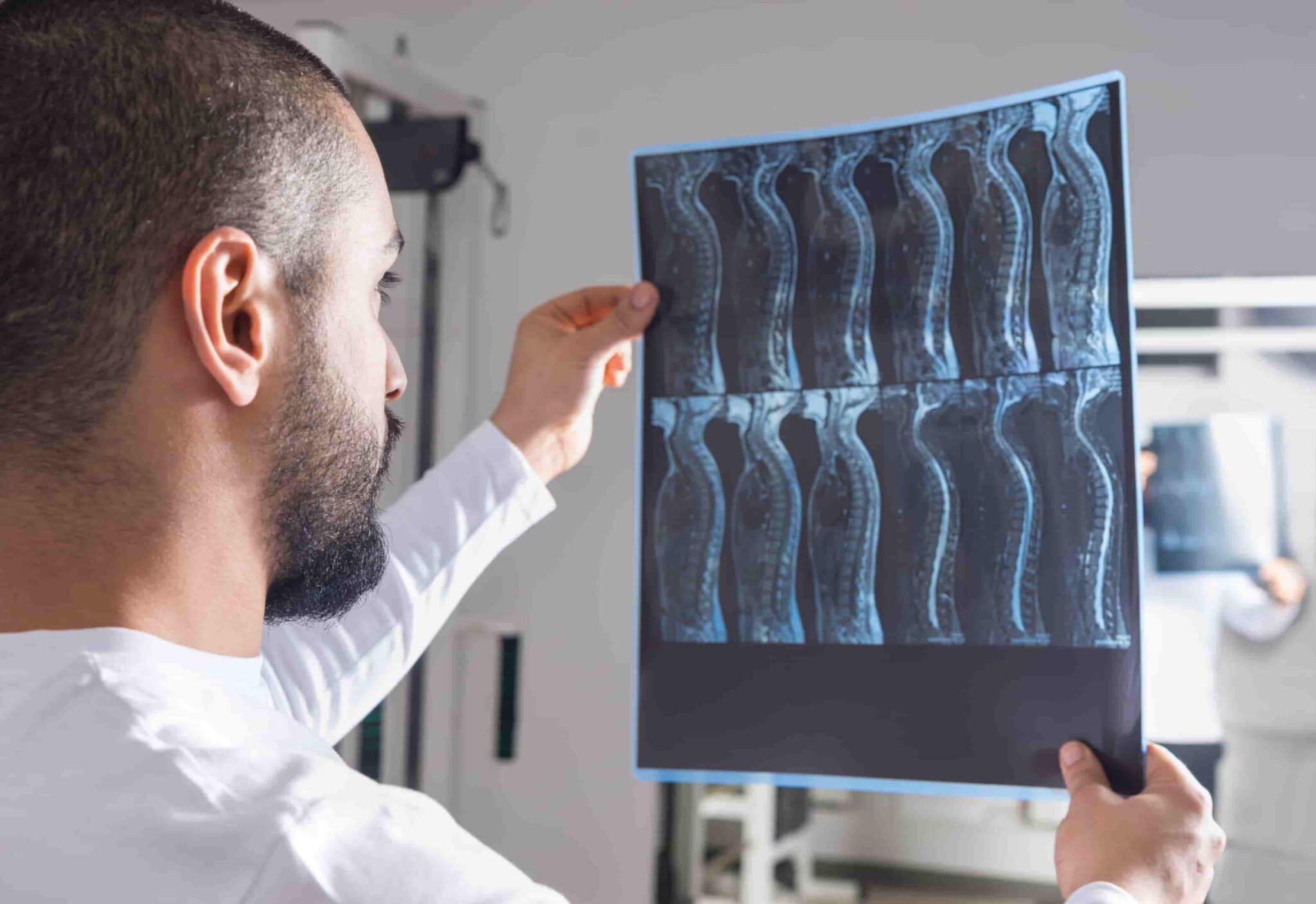 Radiografia da Coluna (raio-x coluna): quando realizar? - ITC Vertebral
