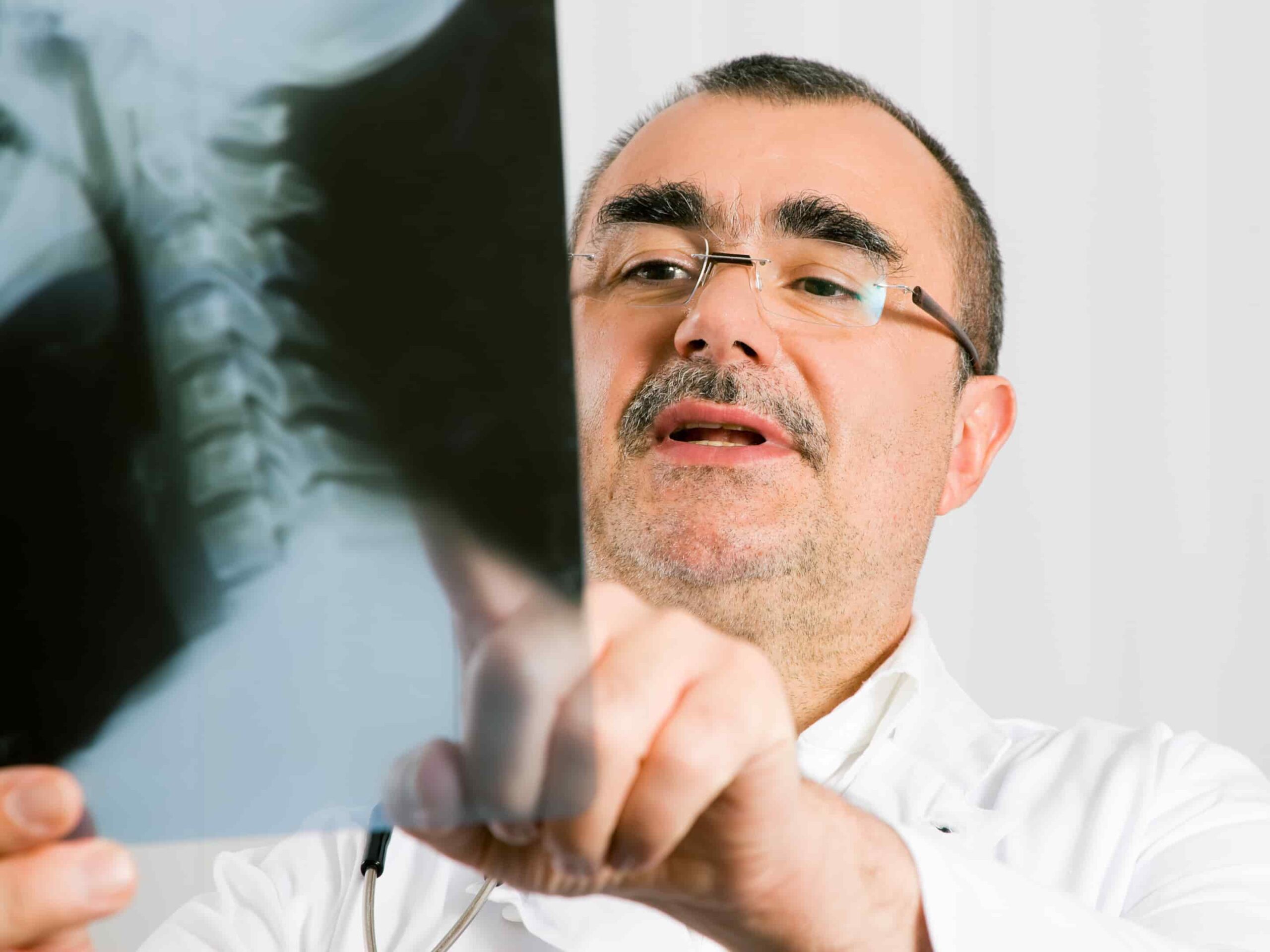 Radiografia da Coluna (raio-x coluna): quando realizar? - ITC Vertebral