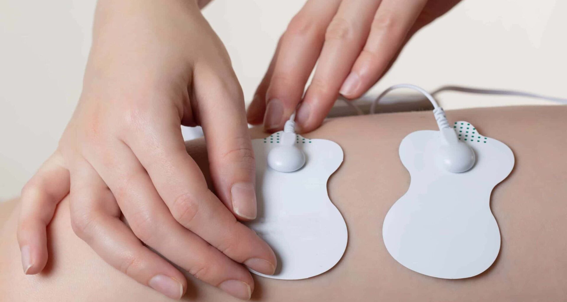 TENS: o que é, para que serve, como utilizar, funciona mesmo? - ITC ...