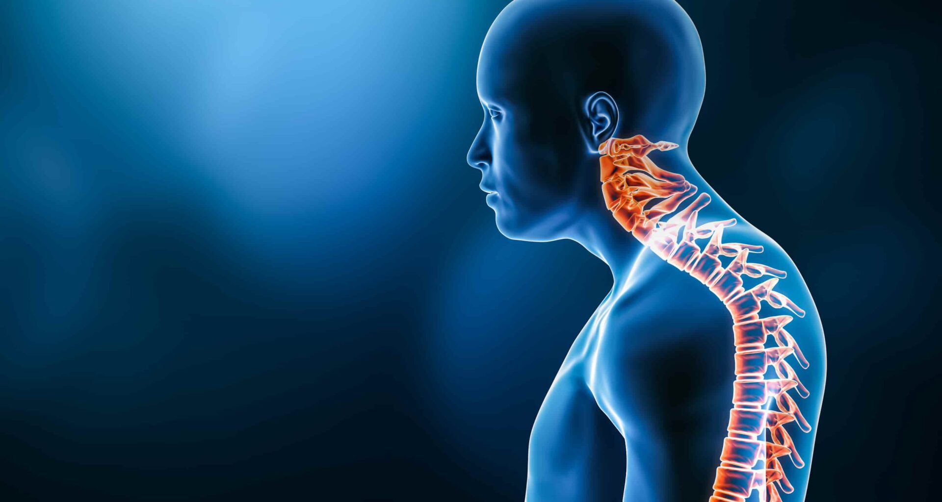 Por que a pessoa fica Corcunda? - ITC Vertebral